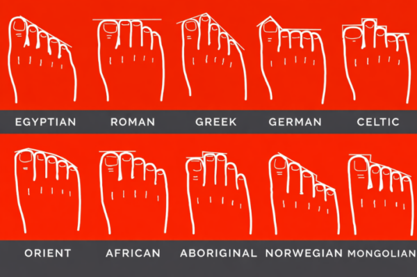 Choose Your Foot Type for Better Shoe Fit & Comfort